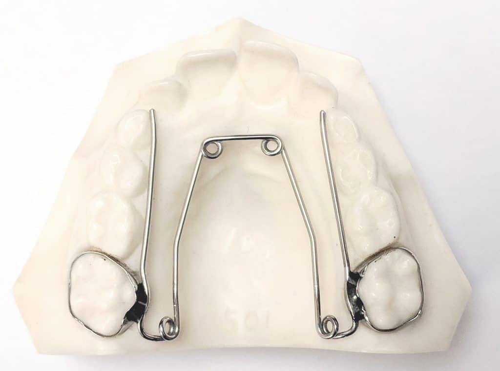 expander2 | True Orthodontics, PC
